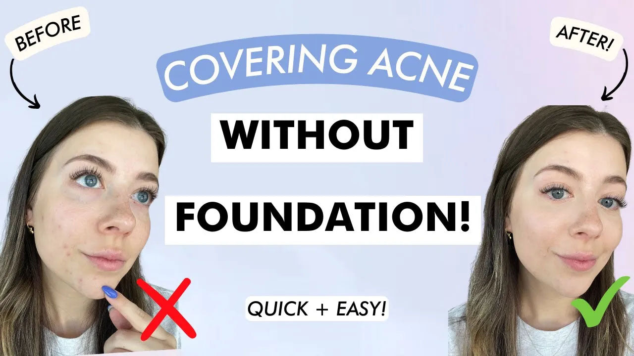how to cover acne with just one product! skip the foundation – Subtl Beauty